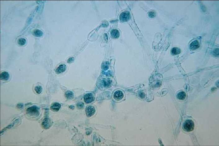 厚垣孢子_360百科