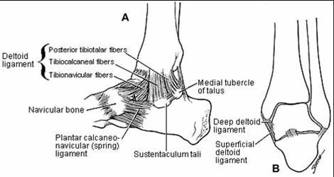 撕脱性骨折_360百科