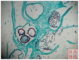 异形孢子_360百科